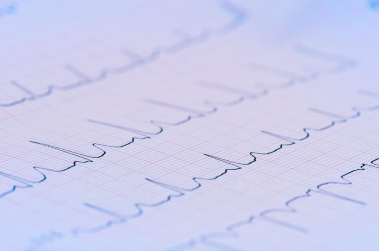 The Complete Electroencephalography Guide [Part 1] | Mentalab