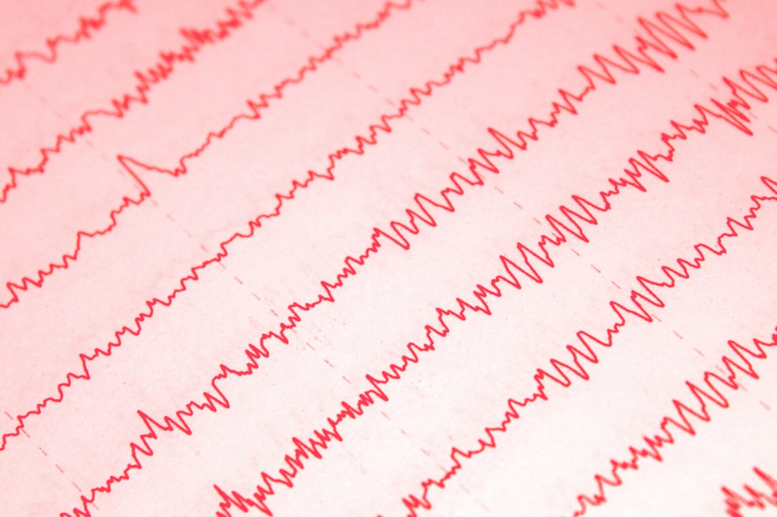The Complete Electroencephalography Guide [Part 2] | Mentalab